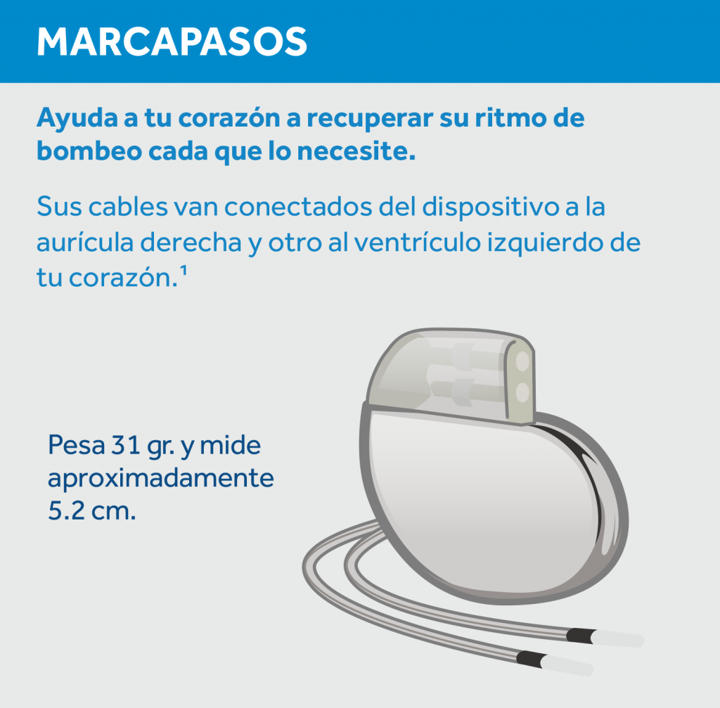 Entendiendo los dispositivos cardíacos implantables - العناية بصحة قلبك